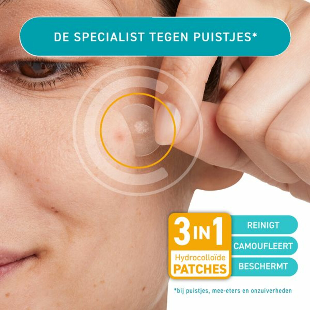 Compeed Anti Spots Small 15 stuks | Plein.nl