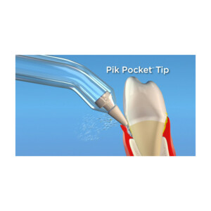 Waterpik Classic Pik Pocket Tips PP-70E 2 stuks | Plein.nl